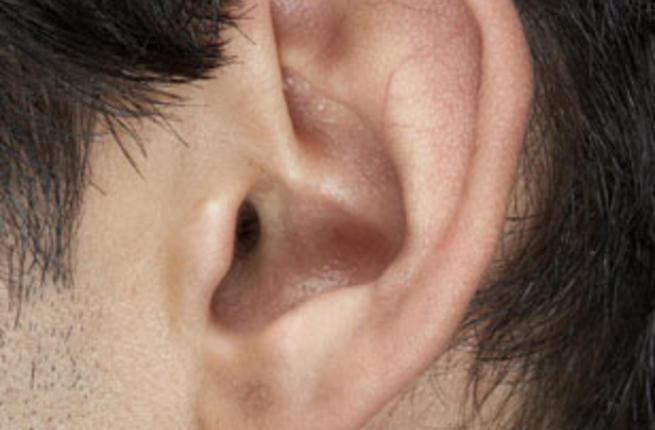 تراكم شمع الاذن يمكن أن يسبب فقدان السمع | البوابة